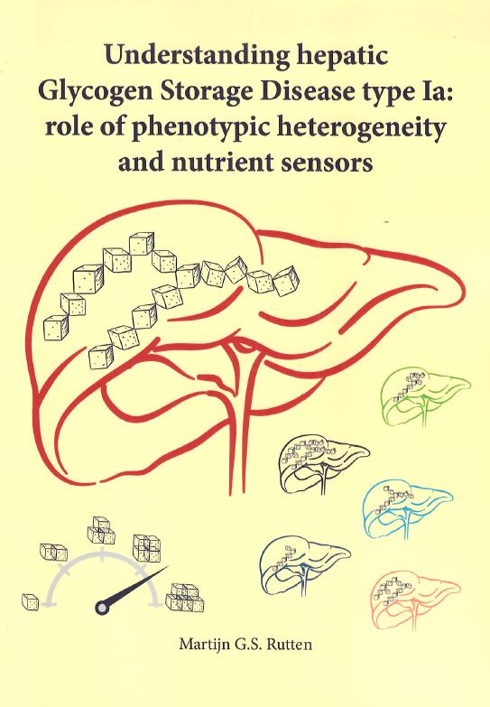Understanding hepatic Glycogen Storage Disease type Ia: role of ...
